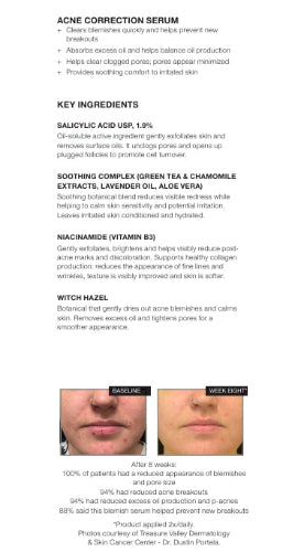 Acne Correction Serum – Orah Skin Care